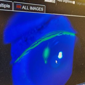 FREMONT EYE CARE PHYSICIANS - Updated December 2025 - 29 Photos & 142 ...