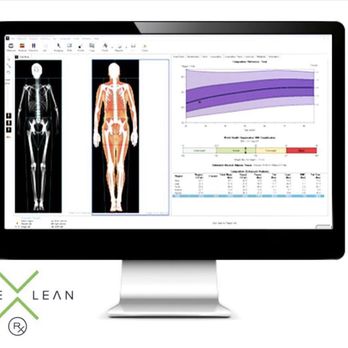LIVE LEAN RX ATLANTA - Updated October 2025 - 6100 Lake Forrest Dr ...