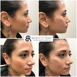 BODY BY RAVI PLASTIC SURGERY AND AESTHETICS - 118 Photos & 22 Reviews ...