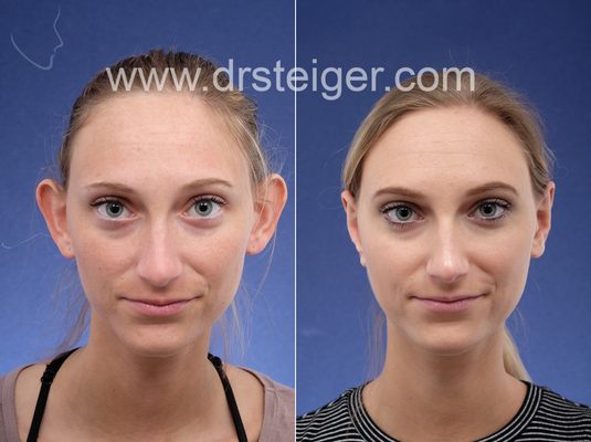 STEIGER FACIAL PLASTIC SURGERY - Updated January 2025 - 19 Photos & 46 ...
