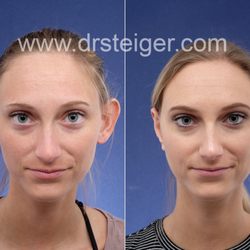 STEIGER FACIAL PLASTIC SURGERY - 19 Photos & 32 Reviews - Medical Spas ...