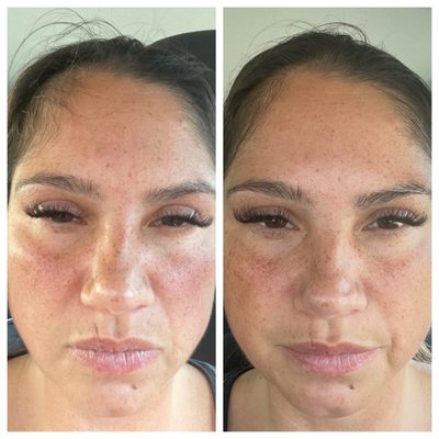 LILLY BEAUTY MEDICAL SPA - Updated November 2025 - 36 Photos & 85 ...