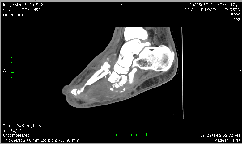 STEVEN SHOEMAKER, DPM, FACFAS - Updated December 2025 - 19 Photos & 65 ...