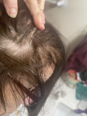 CLEMENS ESCHE, MD, FAAD - Updated October 2025 - 16 Reviews - 6155 ...