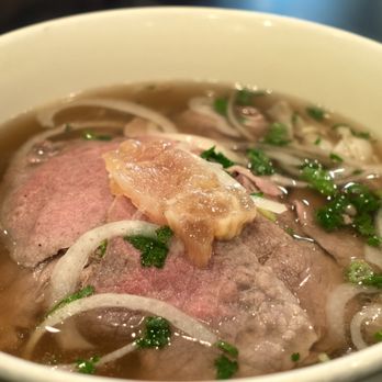 PHO 86 - Updated December 2025 - 245 Photos & 118 Reviews - 1944 86th ...