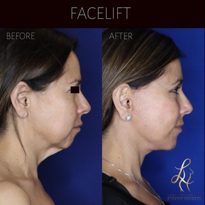 LISA HWANG, MD - Updated January 2026 - 282 Photos & 41 Reviews - 3803 ...