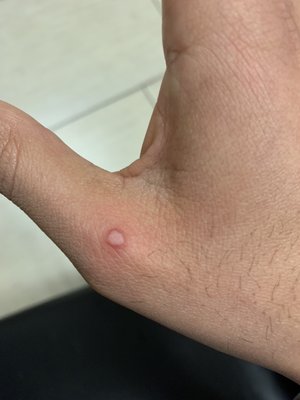 PEDRAM GHASRI, MD, FAAD - Updated June 2025 - 25 Reviews - 18555 ...