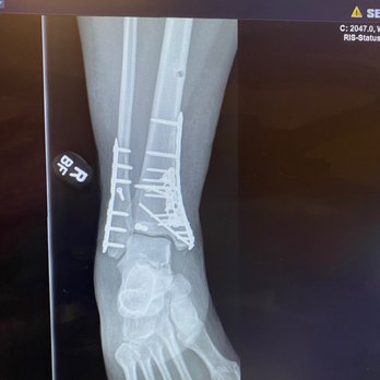 UNIVERSITY HOSPITALS TRIPOINT MEDICAL CENTER - Updated December 2025 ...