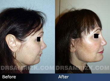 SAM RIZK, MD - Updated October 2025 - 102 Photos & 63 Reviews - 1040 ...