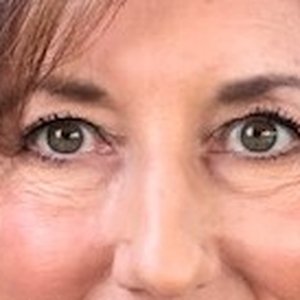 CHENG PLASTIC SURGERY - 136 Photos & 188 Reviews - Cosmetic Surgeons ...