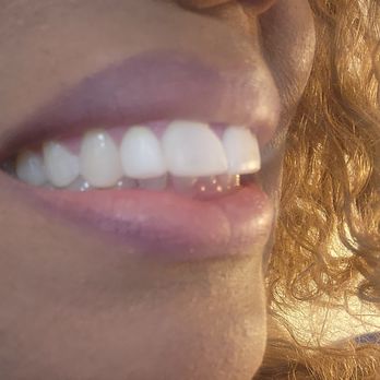 LAUREL SMILES DENTAL CARE - Updated January 2026 - 14440 Cherry Lane Ct ...