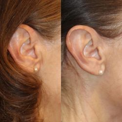 EVAN RANSOM, MD - 123 Photos & 171 Reviews - Cosmetic Surgeons - 450 ...