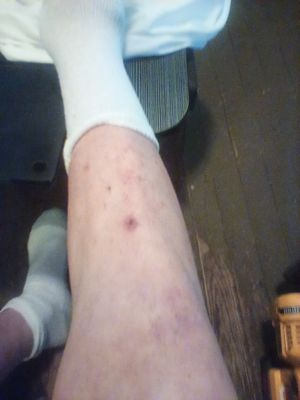 BATES MILL DERMATOLOGY - Updated January 2026 - 19 Reviews - 70 Lincoln ...