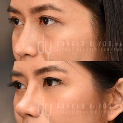 DONALD B YOO, MD, FACS - 374 Photos & 161 Reviews - Cosmetic Surgeons ...