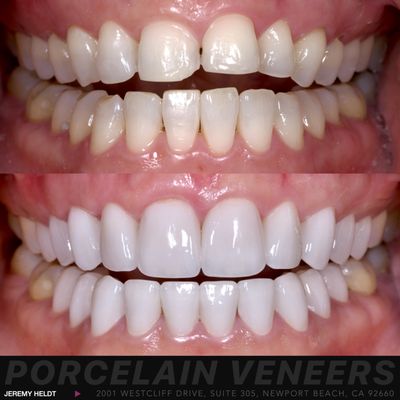 JEREMY HELDT, DDS - Updated March 2025 - 222 Photos & 105 Reviews ...