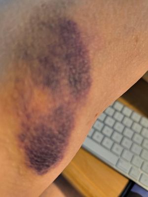 BETH BRAVER, MD - Updated December 2025 - 20 Reviews - 20950 NE 27th Ct ...