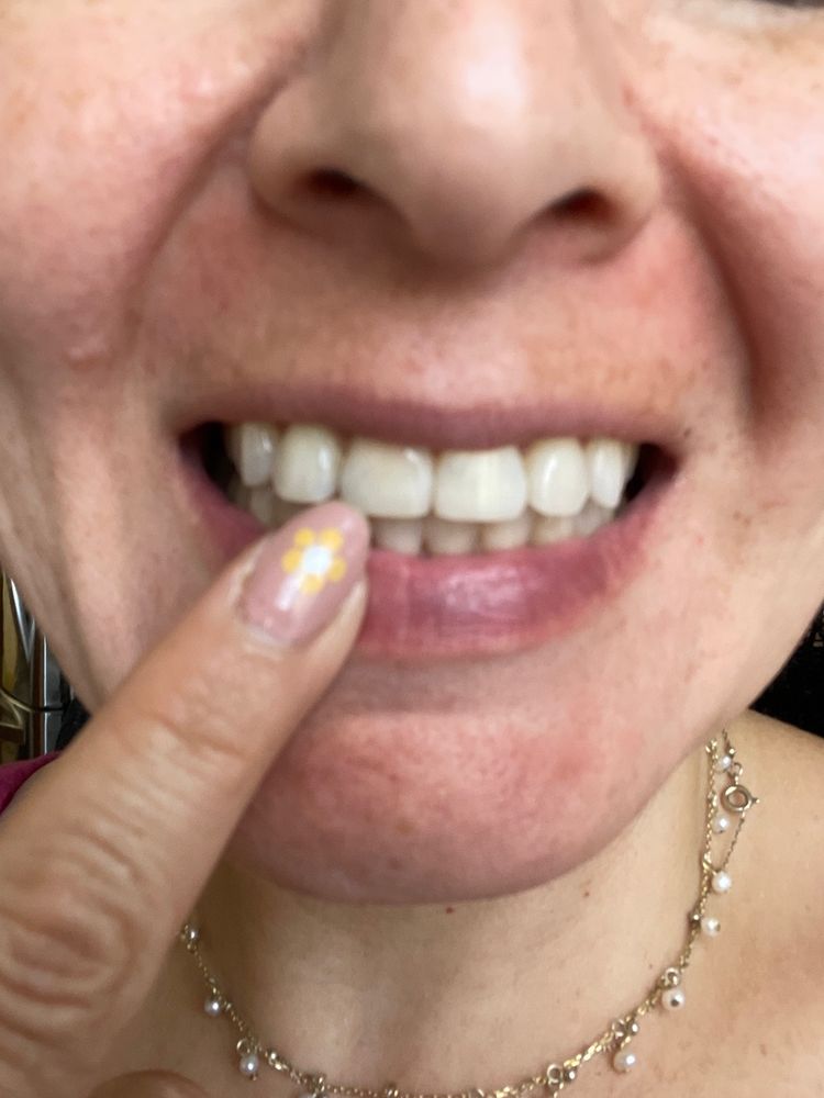 APEX ENDODONTICS - Updated April 2026 - 59 Reviews - 1960 Newport Blvd ...