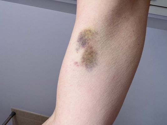 VSI - VIRGINIA SPINE INSTITUTE - Updated January 2026 - 19 Photos & 68 ...