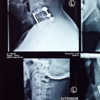 POUYA MOHAJER, MD - Updated March 2025 - 32 Reviews - 5741 S Fort ...