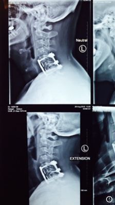 POUYA MOHAJER, MD - Updated December 2025 - 35 Reviews - 5741 S Fort ...