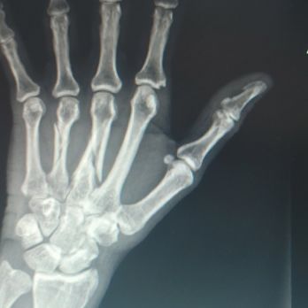 THE MINIMALLY INVASIVE HAND INSTITUTE - Updated July 2025 - 68 Photos ...