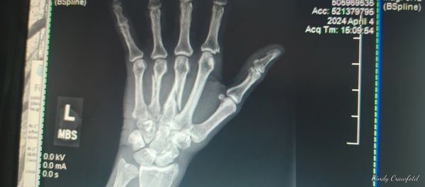 THE MINIMALLY INVASIVE HAND INSTITUTE - Updated July 2025 - 68 Photos ...