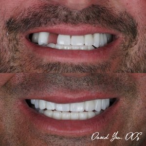 FADI BITAR, DDS - YUCAIPA GENTLE DENTISTRY - Updated October 2025 - 151 ...