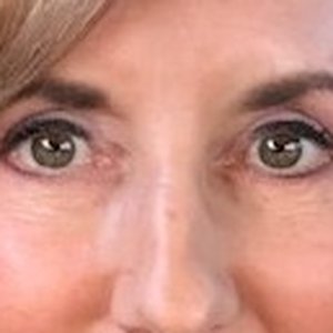 CHENG PLASTIC SURGERY - 142 Photos & 199 Reviews - 12945 Saratoga Ave ...