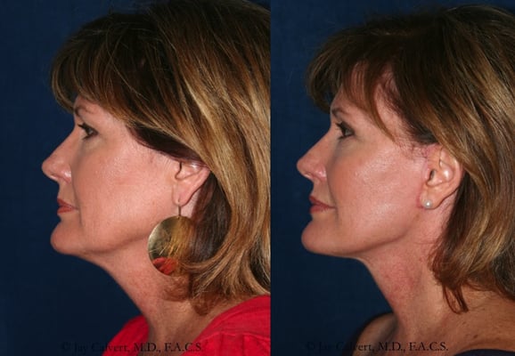 DR JAY CALVERT PLASTIC SURGERY - Updated December 2025 - 39 Photos & 34 ...