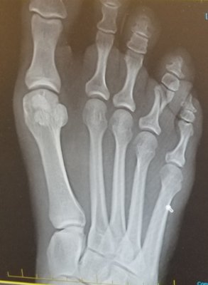 RENO ORTHOPEDIC CENTER ROC EXPRESS URGENT CARE - Updated November 2025 ...