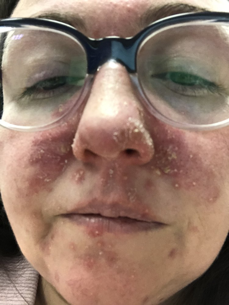 PATRICIA BROTMAN, MD - Updated January 2026 - 37 Reviews - 15944 Los ...