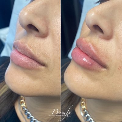 DERMFX - Updated September 2025 - 77 Photos & 97 Reviews - 34184 ...