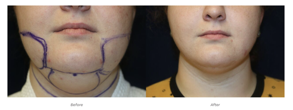 MURPHY PLASTIC SURGERY & MEDICAL SPA - Updated January 2026 - 73 Photos ...