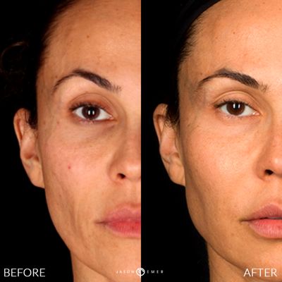 JASON EMER, MD - Updated December 2024 - 1071 Photos & 498 Reviews ...