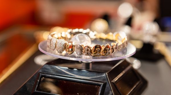 BALTIMORE GOLD FRONTS - 151 Photos - 2429 E Monument St, Baltimore, MD ...