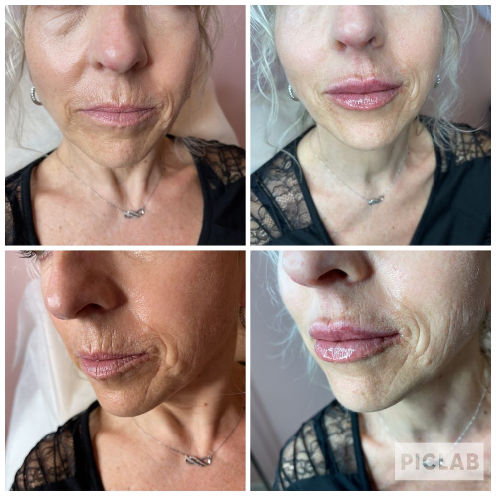 DANIELA BEAUTY NURSE - Updated March 2025 - 12 Photos - Newmarket ...