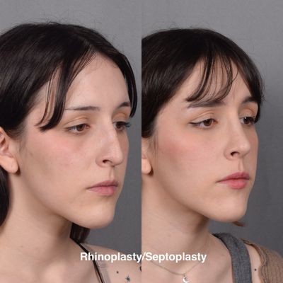 VEGAS FACIAL PLASTICS - MEHDI SINA MD, MBA - Updated August 2025 - 114 ...