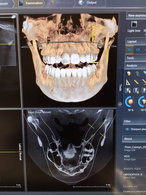 KALEKA DENTAL - Updated January 2026 - 19 Photos & 117 Reviews - 455 ...