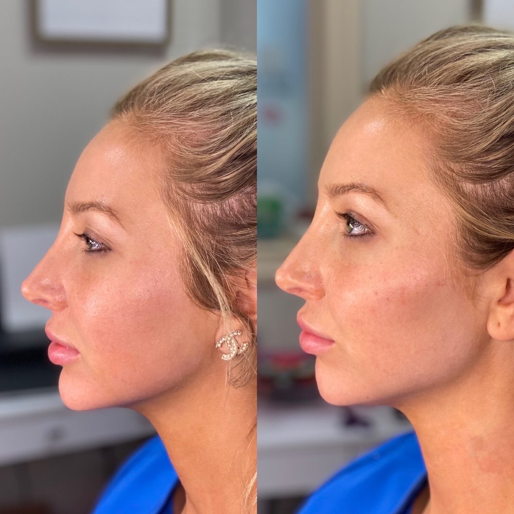 BEAUTY GLOW AESTHETICS - Updated October 2025 - 11 Photos - 12021 ...