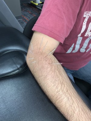 PRECISION SPORTS PHYSICAL THERAPY - Updated December 2025 - 24 Photos ...