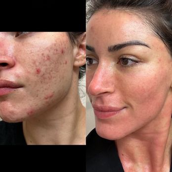 JASON EMER, MD - Updated May 2025 - 1139 Photos & 505 Reviews - 9201 ...