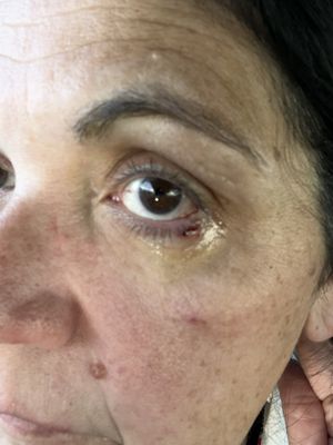 PACIFIC EYE INSTITUTE - TEMECULA - Updated January 2026 - 17 Photos ...