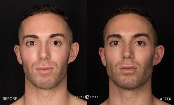 JASON EMER, MD - 996 Photos & 382 Reviews - 9201 Sunset Blvd, West ...