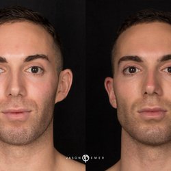 JASON EMER, MD - 995 Photos & 391 Reviews - 9201 Sunset Blvd, West ...