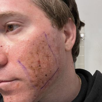 JASON EMER, MD - Updated December 2025 - 1166 Photos & 520 Reviews ...