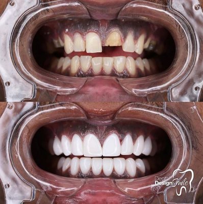 DENTAL DESIGN SMILE - Updated June 2025 - 41 Photos & 51 Reviews ...