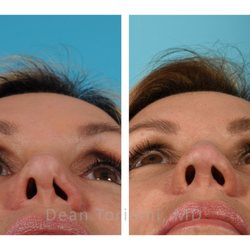 DEAN TORIUMI, MD - 48 Photos & 33 Reviews - 60 E Delaware Pl, Chicago ...