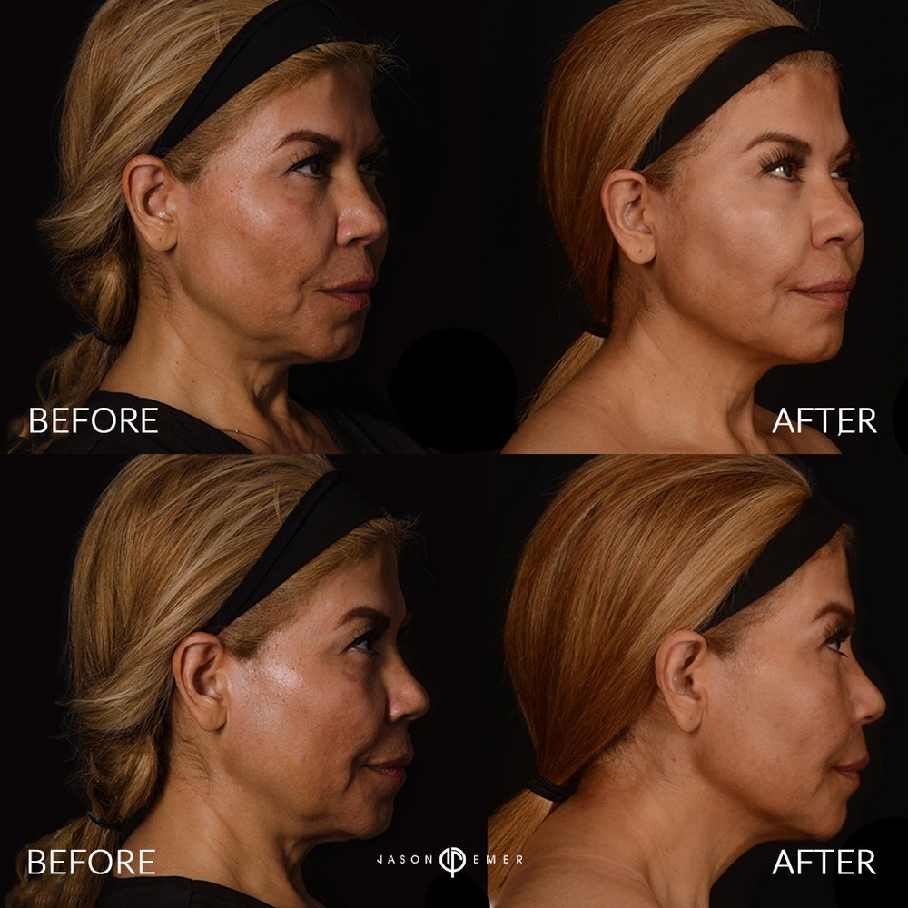 JASON EMER, MD - 914 Photos & 365 Reviews - Dermatologists - 9201 ...