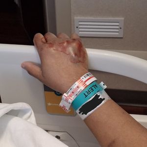 DECATUR MORGAN HOSPITAL - Updated October 2025 - 18 Reviews - 1201 7th ...