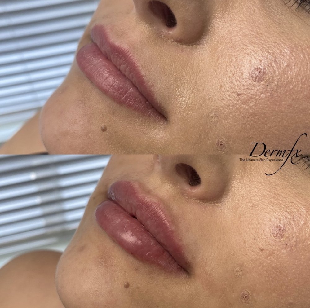 DERMFX - Updated December 2025 - 173 Photos & 284 Reviews - 3443 E ...